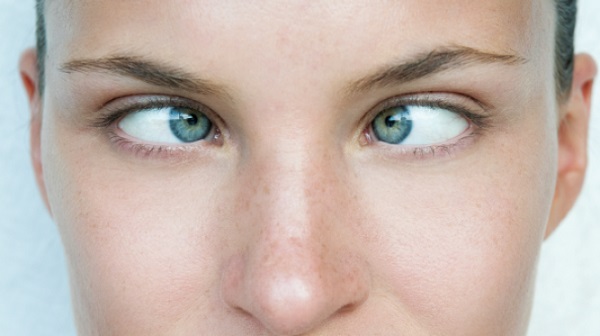 STRABISMUS - Best Medical Care Service, Medical Arrow - Medical Tourism ...